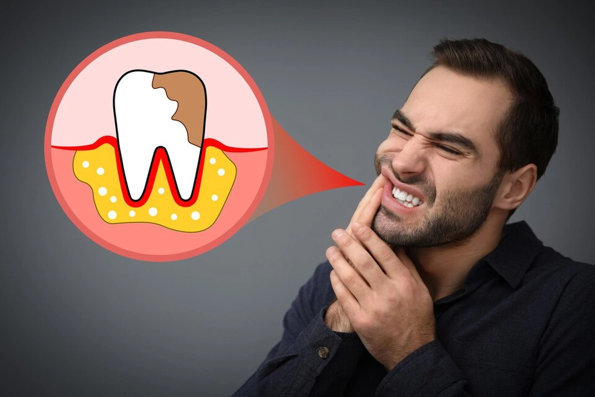 Top 5 Hidden Risks of Tooth Decay & How to Protect Your Smile